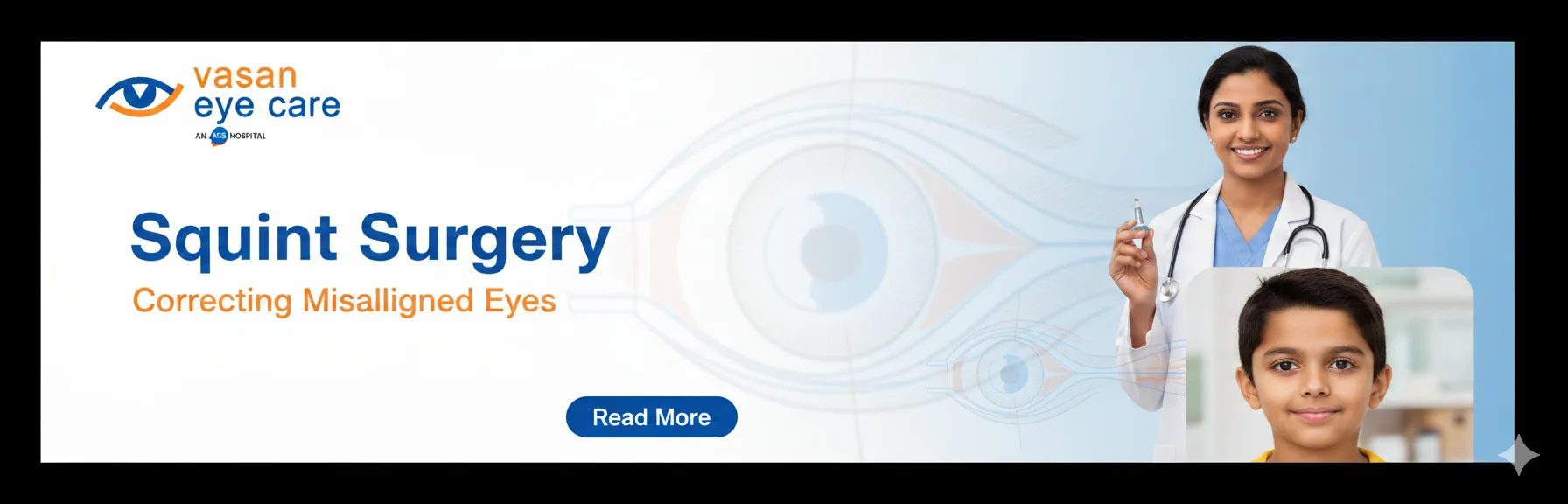 Squint Surgery in Kerala Thrissur | Vasan Eye Care & Treatment